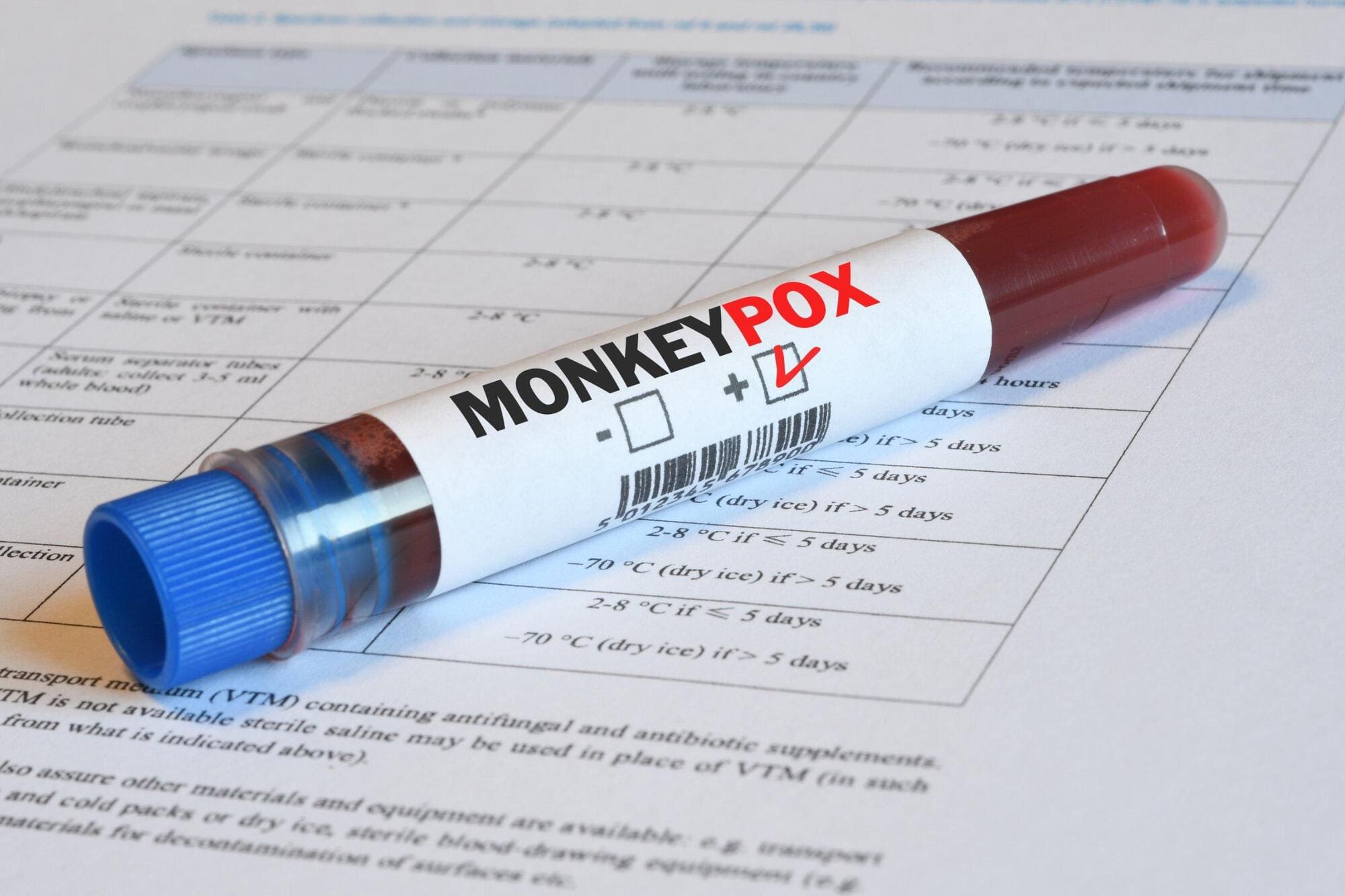 What is Monkeypox? | Signs, treatment, diagnosis & transmission