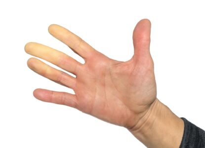 All about HAVS | Risks, Prevention, Symptoms & Cures